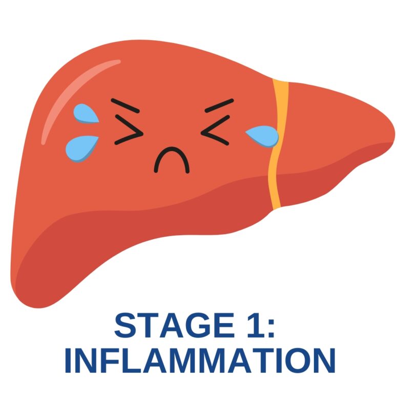 What Are The Four Stages of Liver Disease